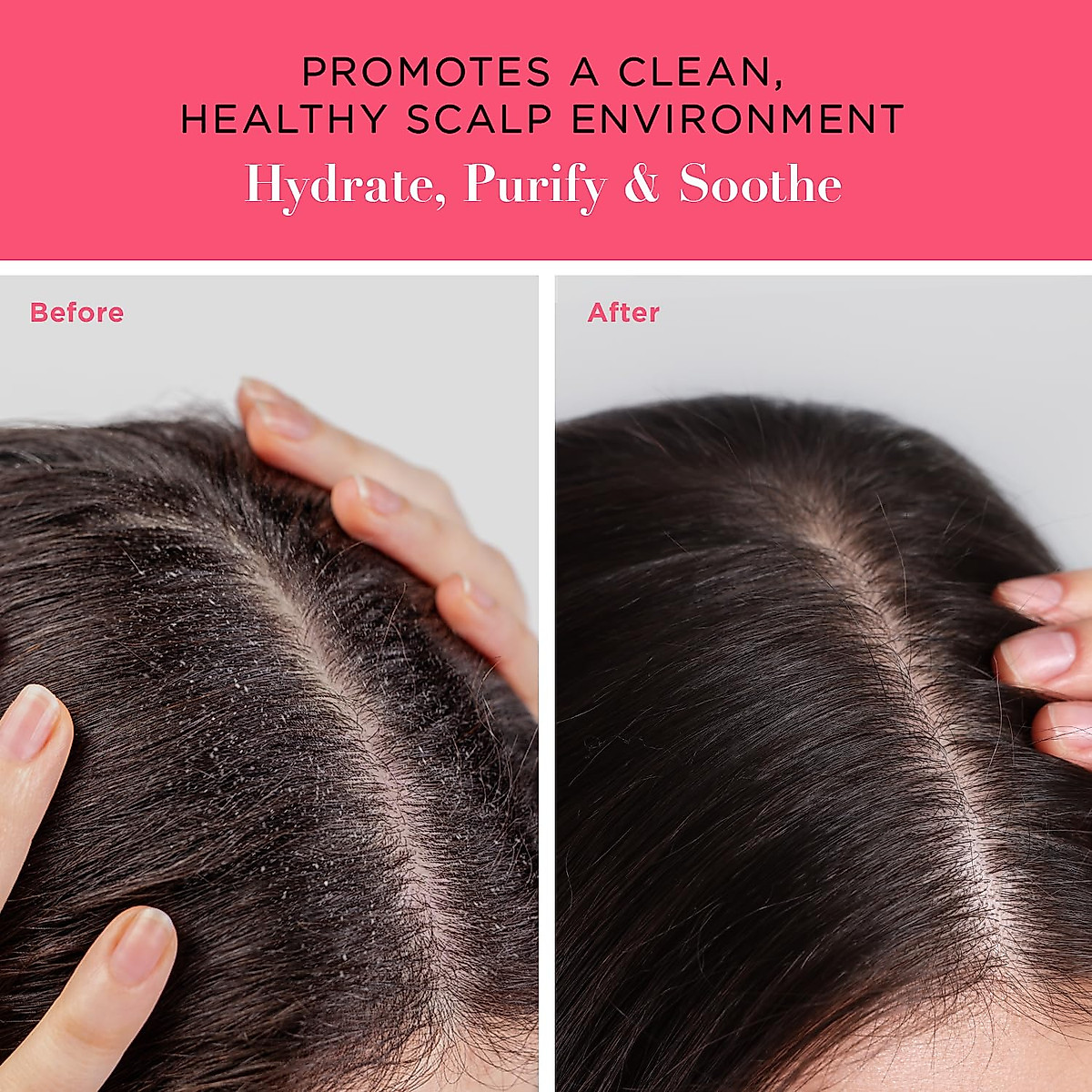 Unwash Balancing Scalp Serum - Nourish & Soothe Dry, Flaky Itchy Scalp, Nourishing Scalp Treatment, Balances Moisture, Micriobiome Friendly, Sulfate Free, 2.5 fl oz