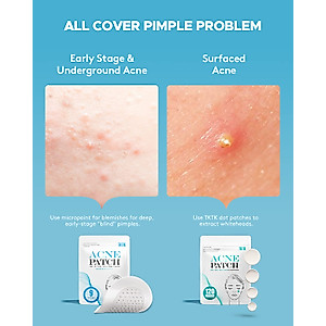 TKTK Self-Dissolving Microdart Acne Pimple Patches for Zits and Blemishes with 100% Pure Hyaluronic Acid, 4 Sizes Acne Absorbing Cover Patch, Acne Spot Treatment Stickers for Face and Skin (99 Count)