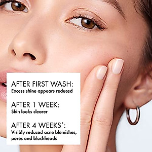 Vichy Normaderm Daily Acne Face Wash, Salicylic Acid Face Cleanser for Oily & Acne Prone Skin, Acne Cleanser that Clears Clogged Pores and Blackheads, Cleansing Gel for Clear Skin