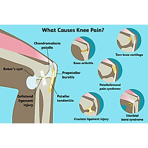 WC_ Black Knee Support brace with Open Patella, Knee Sleeve for Running, Jogging, Sports, Joint Pain Relief, Arthritis and Injury Recovery for Men and Women