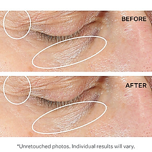 StriVectin Anti-Wrinkle Intensive Eye Cream Concentrate for Wrinkles PLUS, Targets Crow's Feet, Firmness, Puffiness & Dark Circles,White, 0.25 Fl oz (Pack of 1)