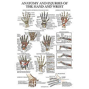 Laminated Anatomy and Injuries of the Hand and Wrist Poster - Hand and Wrist Joint Anatomical Chart - 18" x 24"