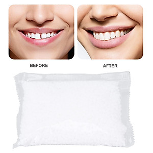 100g Moldable Thermal Fitting Bead, Temporary Tooth Filling Repair Accessory for Halloween Party Teeth Replacement Kit Restoration