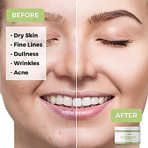 Teami Matcha Green Tea Facial Scrub For Hydrating, Moisturizing, and Exfoliating, Natural Exfoliating Body & Face Scrub, Organic Face Exfoliator Sugar Scrub with Lemongrass, Non-Greasy Face Exfoliant