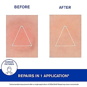 Uriage Bariederm CICA-Daily Gel-Cream 1.35 fl.oz. | Anti-Aging Face Cream that Prevents Fine Lines & Visible Imperfections | Hydrating Skin Therapy with Centella Asiatica & Hyaluronic Acid