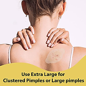 HARUTO Acne Pimple Patches XL (10 patches/1 pack) - Hydrocolloid Large acne Patches Spot Treatment, Tea tree spot patch, acne sticker for Body and Larger Breakouts,