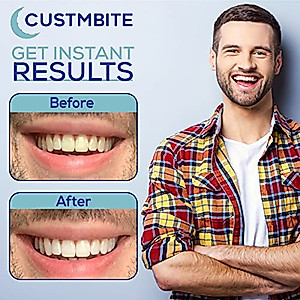 CustMbite Premium Teeth Whitening Gel Applicator, 16% Carbamide Peroxide, (5) 3ml Applicators