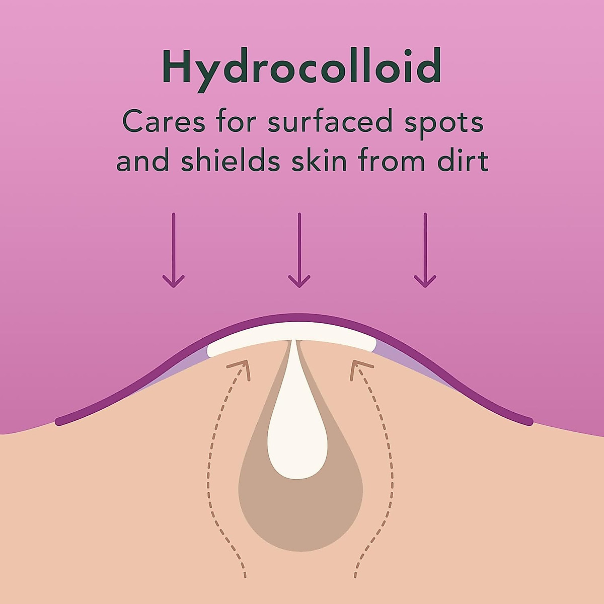 Rael Pimple Patches - Miracle Overnight Spot Cover, Thicker & Extra Adhesion, Hydrocolloid Acne Treatment for Face, Zits & Blemishes, Korean Skin Care, Vegan & Cruelty-Free, 3 Sizes (52 Count)