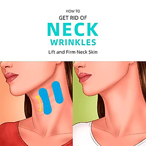 Kindmax Face Tape, 2 Rolls, Anti Wrinkles Patches, Face Eye Neck Lift Tape, V Line Lifting Chin Strap, Face Toning Belts, High Elasticity, Firming and Tightening Skin 2.5cm*5m (Beige)