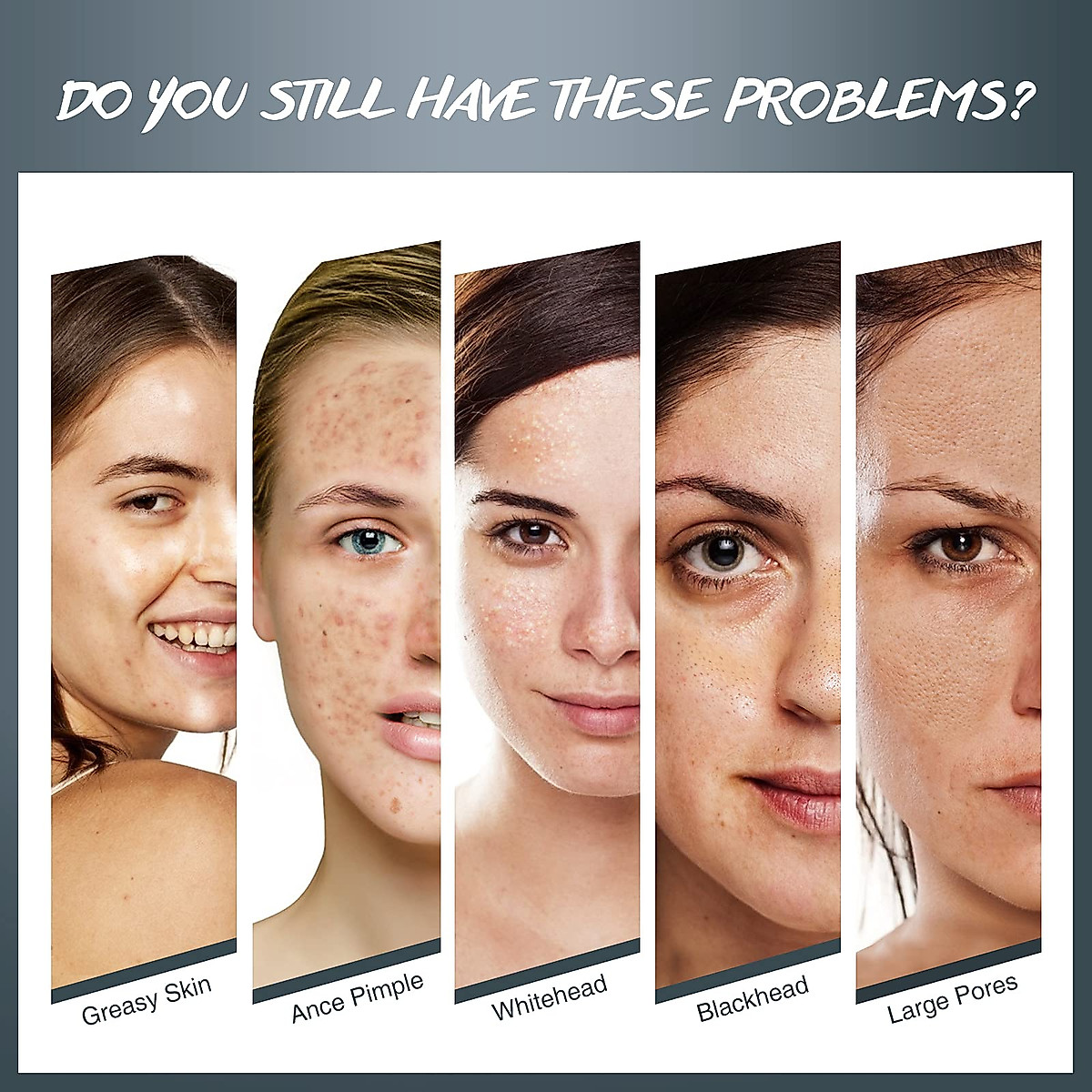 POP MODERN.C Blackhead Remover Mask with Tea Tree Cream Charcoal Peel Off Facial Mask Blackheads Whiteheads Removal Deep Cleansing Pore Purifying Acne Face Mask with Brush Pimple Extractor 4-in-1 Kit