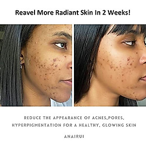 ANAI RUI Turmeric Vitamin C Face Mask for Dark Spots, Kaolin Clay Mask with Vitamin C E and Aloe, Skin Care Turmeric Clay Mask for Acne & Refineing Pores, Smooth & Radiant Skin, 4.23 OZ