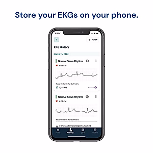 KardiaMobile 1-Lead Personal EKG Monitor – Record EKGs at Home – Detects AFib and Irregular Arrhythmias – Instant Results in 30 Seconds – Easy to Use – Works with Most Smartphones - FSA/HSA Eligible