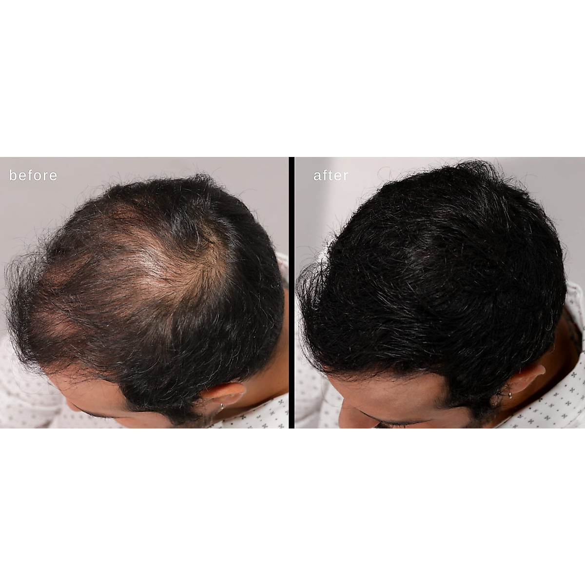 LUXE Hair Thickening Fibers - CONFIDENCE IN A JAR – 2 Months+ Supply! – Hypoallergenic, Dermatologist Tested – Multiple Colors Available (Dark Brown)