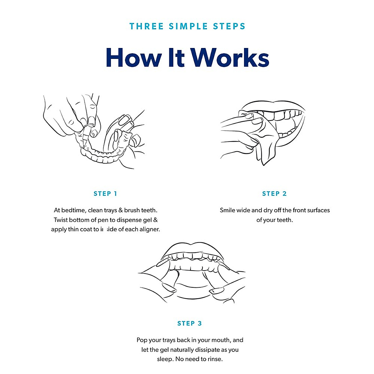 EverSmile AlignerWhite Teeth Whitening Pen | for Clear Aligners and Retainers, Aligner Whitener, Gel Whitening Pen in Fresh Mint. Twist, Apply and Smile!
