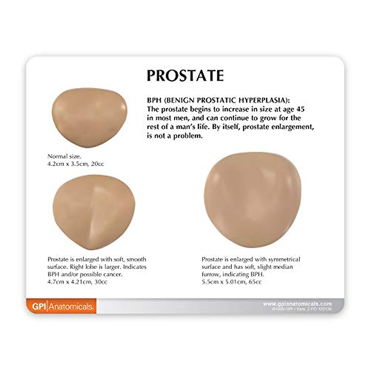 GPI Anatomicals - Male Pelvis Model | Human Body Anatomy Replica of Male Pelvis w/Separate Prostate for Doctors Office Educational Tool