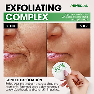 Glycolic Acid Resurfacing Pads for Face and Body - 30% Exfoliating Facial Peel - Vitamins B5 C E, Green Tea - Glycolic Acid Face Wash – 60 Pre-Moistened Cotton Pads for Face Cleansing and Peeling