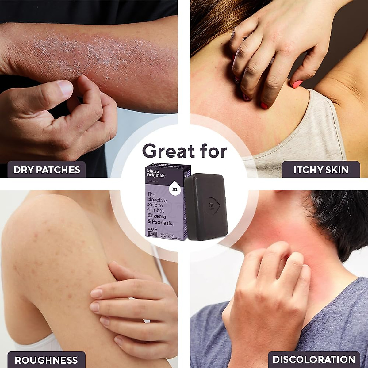 Marie Originals Eczema Face Soap Body Wash Bar – All Natural Psoriasis, Dermatitis Treatment for Dry Itchy Flaky Skin Relief – Gentle Detoxifying, Healing, Anti-Itch, Cleansing Skincare (Pack of 1)