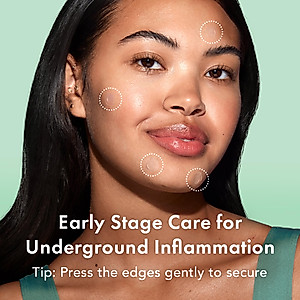 Rael Pimple Patches, Miracle Microcrystal Spot Cover - Hydrocolloid Acne Patch with Tea Tree Oil, Early Stage Zits and Blemish, Korean Skin Care, Vegan, Cruelty Free (36 Count)