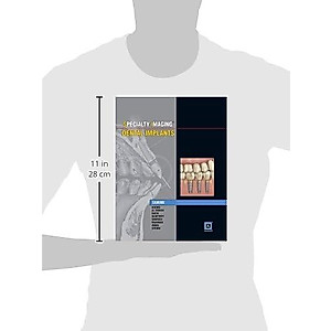 Specialty Imaging: Dental Implants