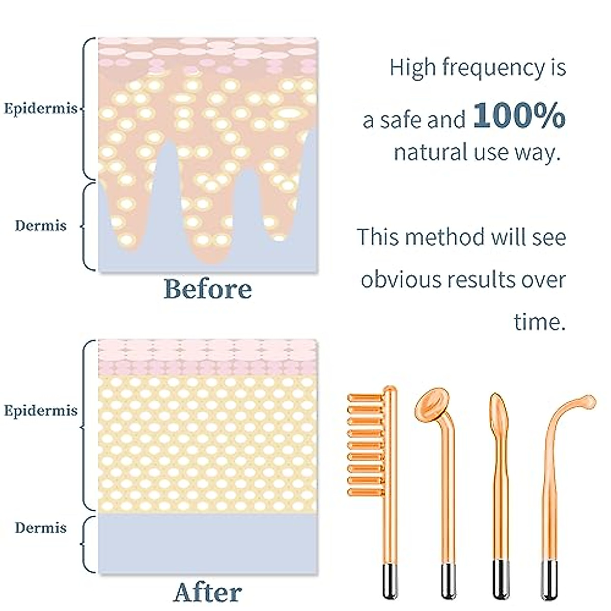High Frequency Facial Machine - TUMAKOU Portable Handheld High Frequency Facial Skin Wand Machine with 4 Different Tubes