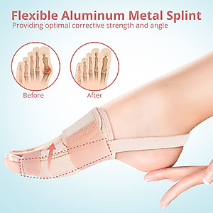 PEDIGOO Bunion Corrector for Women and Men, Slip Proofing Version Bunion Toe Separator, Orthopedic Bunion Splint for Big Toe Pain Relief and Toe Straightening