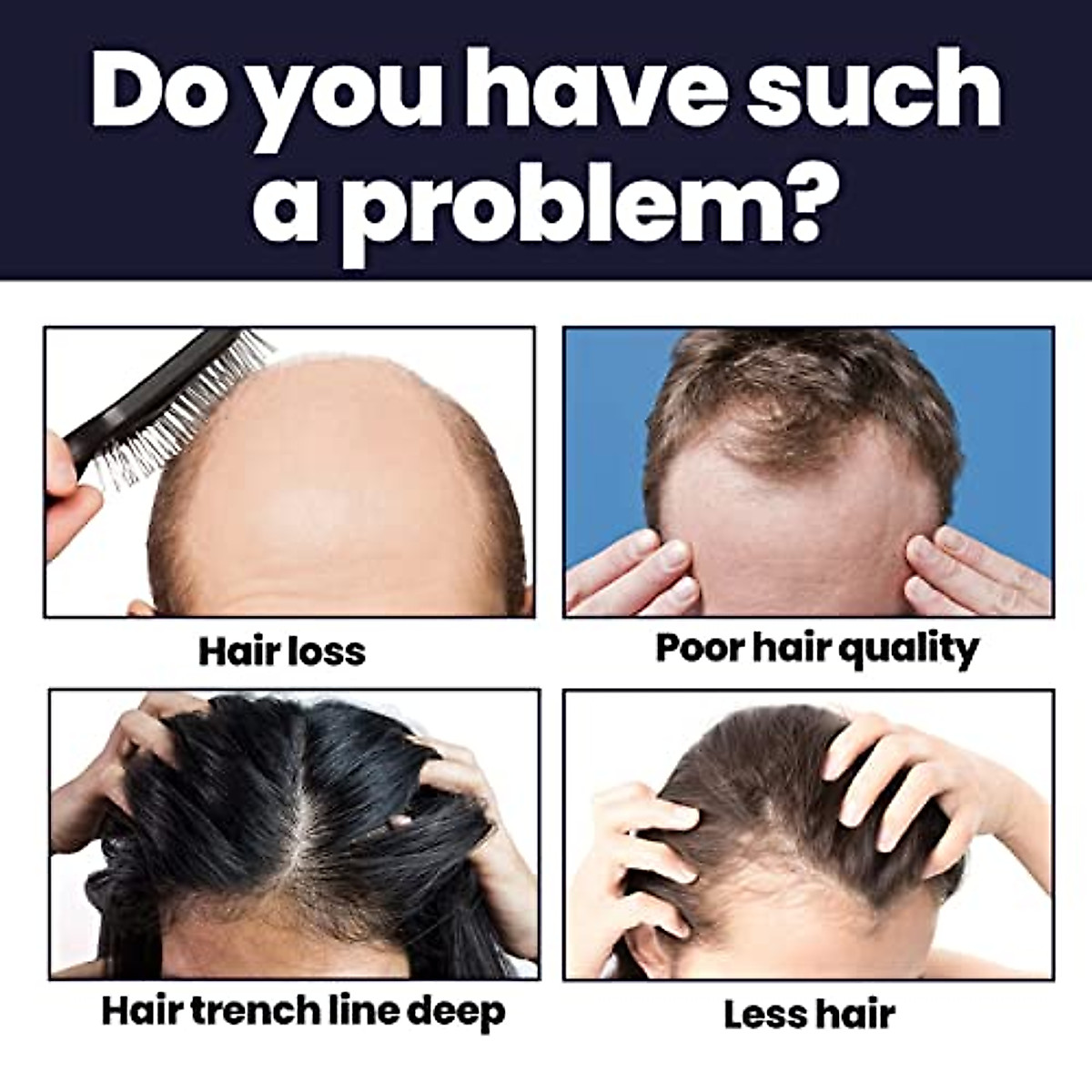 Hair Strengthening Essential Oil, 30ml Hair Growth Essential Oil Nourishing Safe Ingredients Reduce Loss for Daily Use