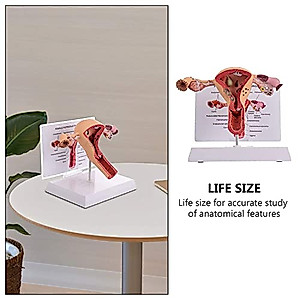ROLTIN Human Pathological Uterus Model Internal Reproductive System Organ Anatomical Model Human Anatomy Model for Medical Training Aid