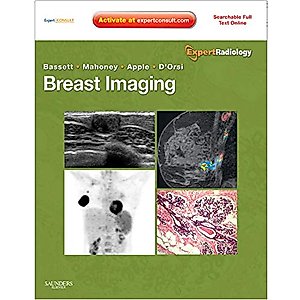 Breast Imaging: Expert Radiology Series