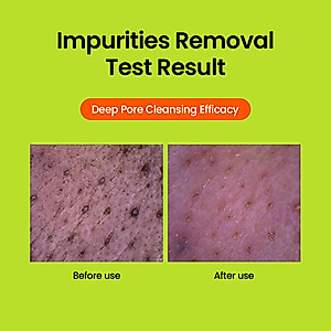 beplain Greenful pH-Balanced Face Wash 5.4 fl oz (160ml) | Gentle Scent-free Natural Face Wash | Face Wash for Acne prone, oily and sensitive skin | Korean Face Wash | k-beauty