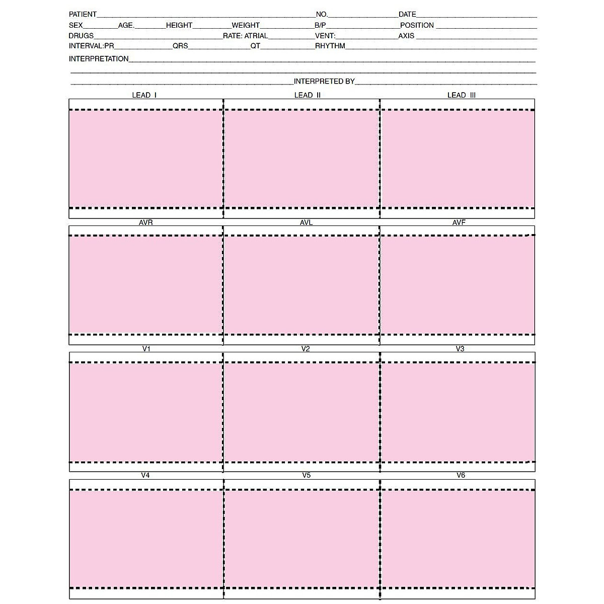 ECG Mount for 12-lead Tracing, 8 1/2" X 11" Portrait Mount Sheet, Peel & Stick, 100/pk