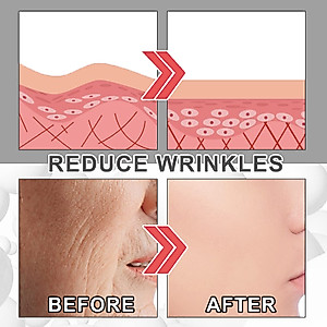 3Pcs EELHOE Collagen Boost Anti Aging Serum, EELHOE Collagen Anti-Wrinkle Cream, Voletas Collagen Boost Anti-Aging Serum