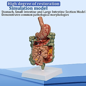 PAASHE Anatomy Model Human Stomach Anatomy Model Organs Model Human Body Model Stomach Section Large Small Intestine Medical Model Study Education