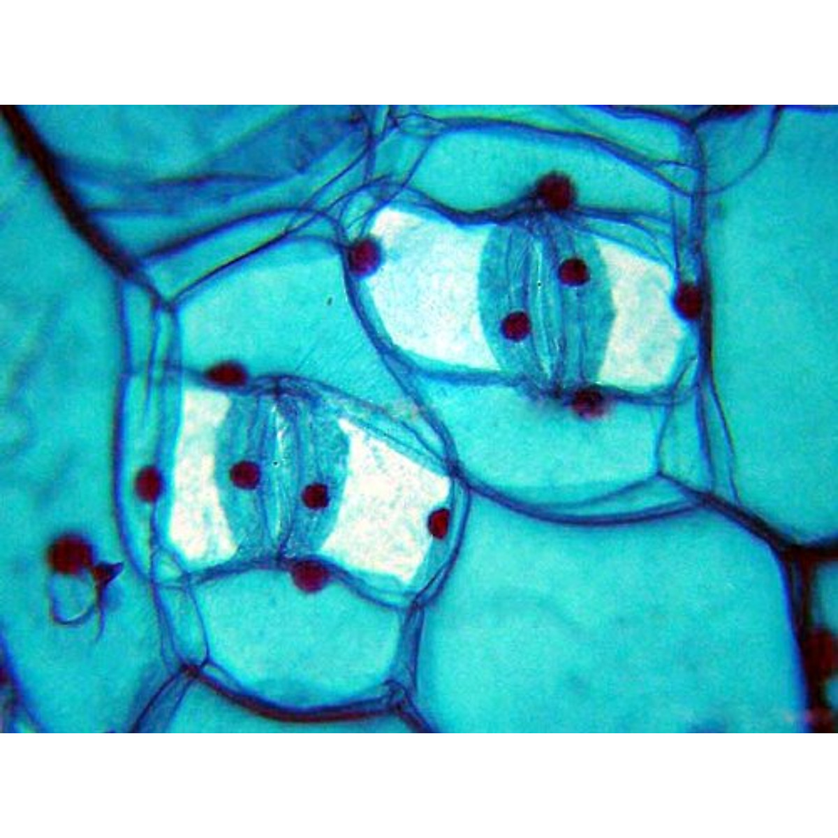 AmScope PS100A Prepared Microscope Slide Set for Basic Biological Science Education, 100 Slides, Set A, Includes Fitted Wooden Case