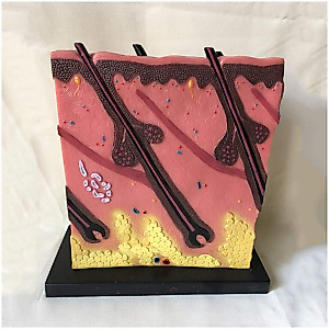 HAILIA Medical Models, Skin Anatomy Model,Hair Follicle Hair Anatomy Model Acne Pustule Blackhead Medical Teaching Model,for Medical Educational Training Aid,Study Display