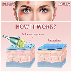 USION Ice Face Roller, Gua Sha Facial Ice Cube Massager Skin Care Tools Ice Roller For Face,Eyes & Neck Naturally Conditioning and Skin Care, Upgraded Facial Ice Mold and Spray Bottle 2 in 1