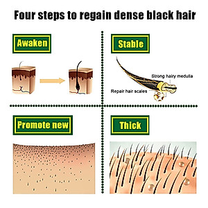 Ginger Hair Growth Germinal Oil, Regrow 7 Days Ginger Germinal Serum for Nourishing Hair Roots, 30ML (3pcs)