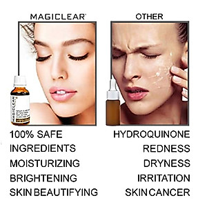 Luxury Dark spot remover for Face and Body Serum - Age spot corrector Acne scar - Anti aging - Bleaching Vitamin C organic Swiss brand Magiclear 30 ml