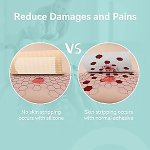 Conkote Silicone Foam Dressings 4'' X 4'', Gentle Adhesive Wound Dressing for Wound Care, Box of 10 Dressings