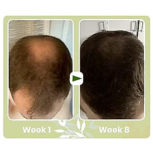 lunhaifi Hairthentic Invigorating Oat & Rice Shampoo Bar,Moisturizing Shampoo Stick,Fermented Rice Water Shampoo Bar,Rice Shampoo Bars for Hair Growth,Anti Hair Loss Rice Water Shampoo Bar (3Pcs)