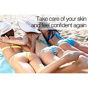 Anti-Acne Buttocks & Thigh Treatment- Clears Away Acne, Pimples, and Ingrown Hairs for the Buttocks and Thigh Area. Prevents Future Breakouts. 6.9 OZ