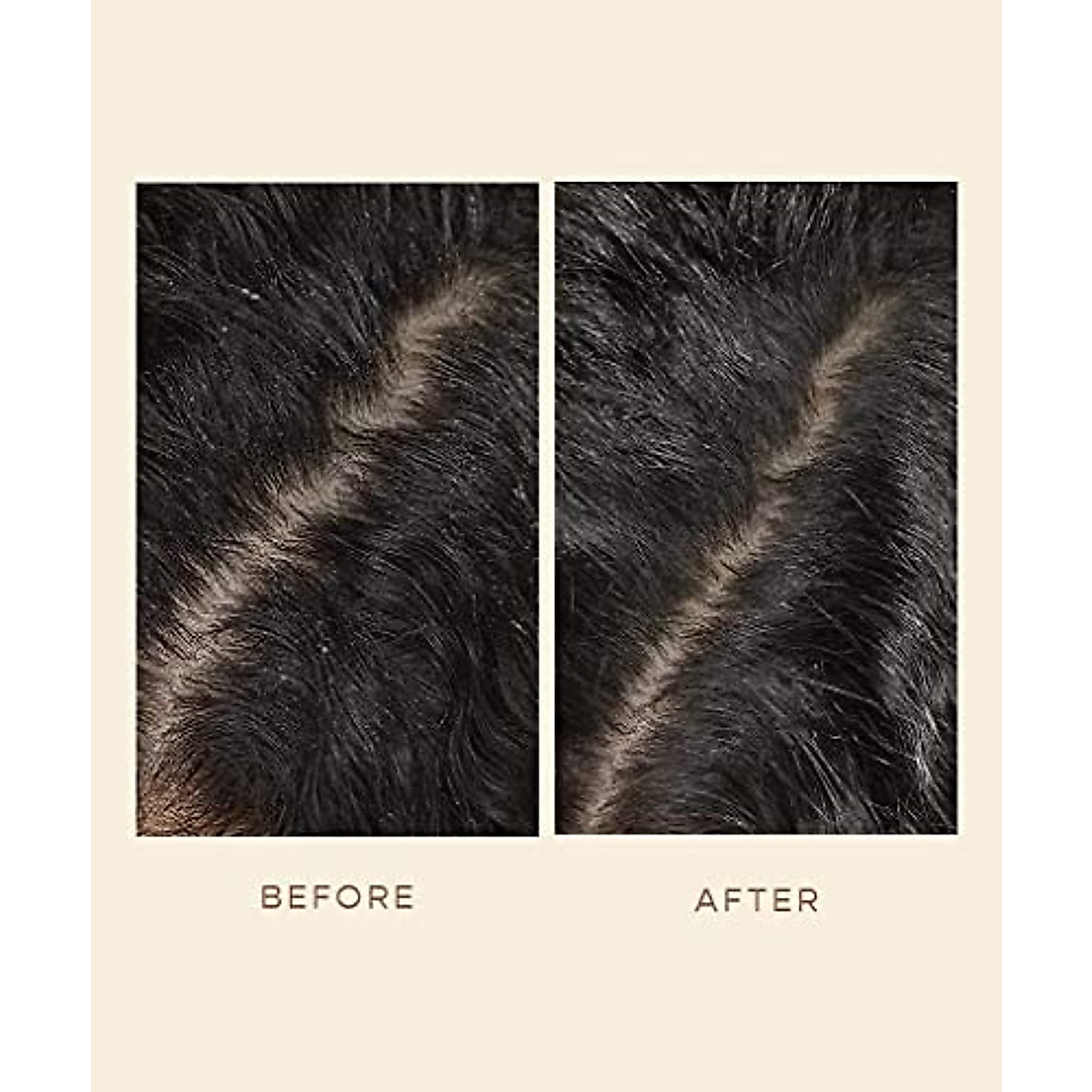 VEGAMOUR GRO Scalp Detoxifying Serum, 2 FL Ounce