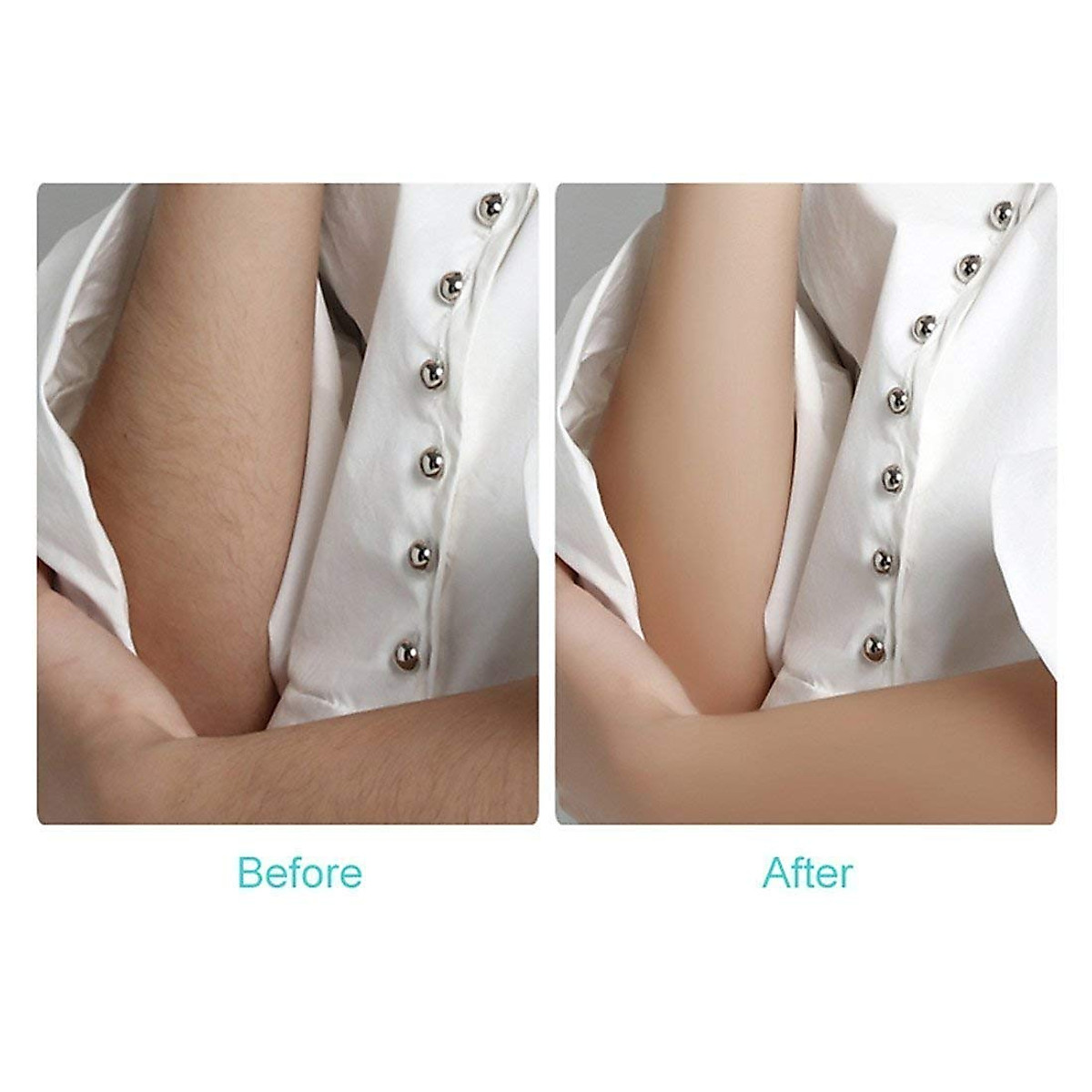 Epilator for Women Hair Removal Tools Epilator Rechargeable Sensor Light Epilator