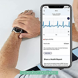 Withings Scanwatch - Smart watch & Activity Tracker: Heart Monitor, Sleep Tracker, Smart Notifications, Step Counter, Waterproof with 30-Day Battery Life, Android & apple smart phone compatible, GPS