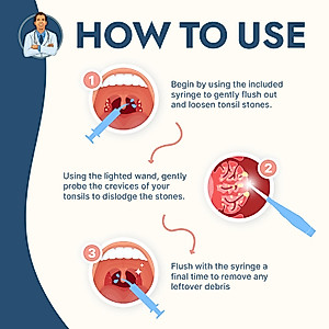 Dr. Frederick’s Original Easy Tonsil Stone Remover Kit - Fast Painless Tonsillolith Removal Tool - Fight Bad Breath - Pick and Oral Irrigator - 8 Pieces