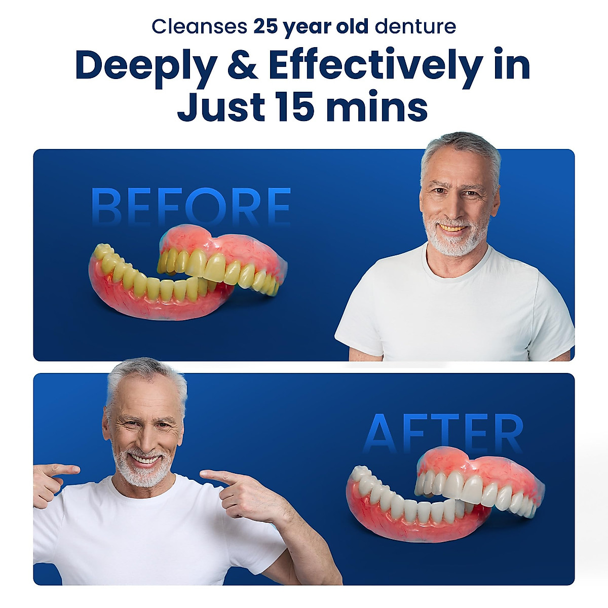 iSonic F3900 Ultrasonic Denture/Aligner/Retainer Cleaner for all dental and sleep apnea appliances, 110V 20W (tank no longer removable) , White , 0.4Pt/0.2L