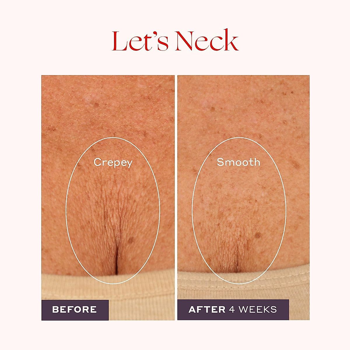 Womaness Let's Neck Firming Serum - Roll On Neck Creams for Tightening and Firming - Daily Crepey Skin Treatment to Smooth Neck Wrinkles & Sagging Skin - Hydrate, Tighten and Lift (50ml)