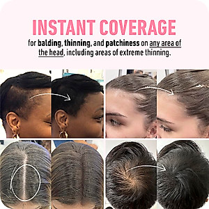 BOLDIFY Hairline Powder for Hair Loss Concealment - Root Touch Up, Hair Toppers for Women & Men, Thinning Hair Fibers, 48-Hour Stain-Proof Formula (Medium Brown)