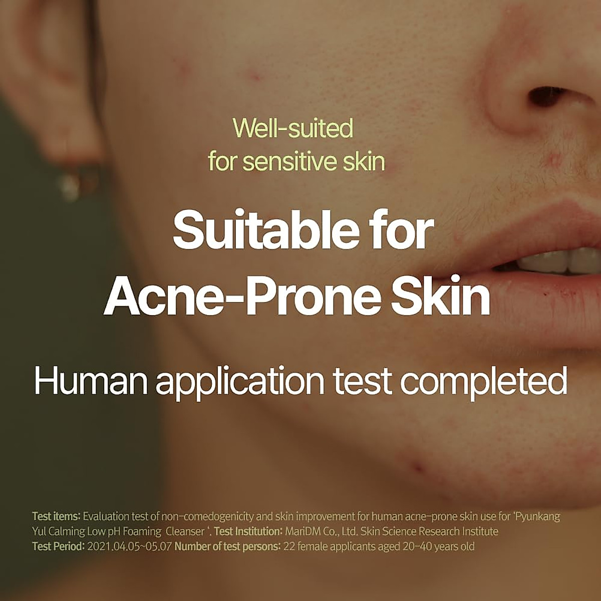 Pyunkang Yul Calming Low pH Foaming Cleanser | Daily Face Wash & Makeup Remover with Tea Tree, Centella Asiatica, 5 Hyaluronic Acids that Removes Dead Skin Cells, Hydrates Skin - 150ml 5.07 Fl.Oz.