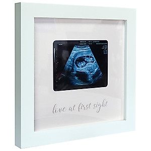 HAMUIERS Love at First Sight Ultrasound Picture Frames, Sonogram Picture Frame, Pregnancy Announcement for Grandparents, Baby Announcement Ideas Ultrasound Photo Frame Nursery Décor, White