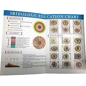 Iriscope Iridology Camera 5.0 MP LED Light Iris Analyser Iridoscope iriscopio